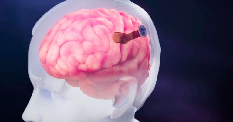 New Brain Implant Allows Paralyzed Patients to Control Digital Devices ...